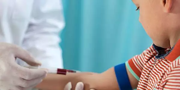 Anemia infantil | Causas, tratamentos e sintomas – Clinica Primeiro ...